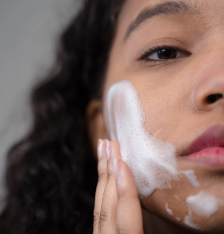 Debunking the Myth: Acne is an Inflammatory Disease – by valenti®